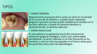 HÁBITOS DE HIGIENE DENTAL | PPTX