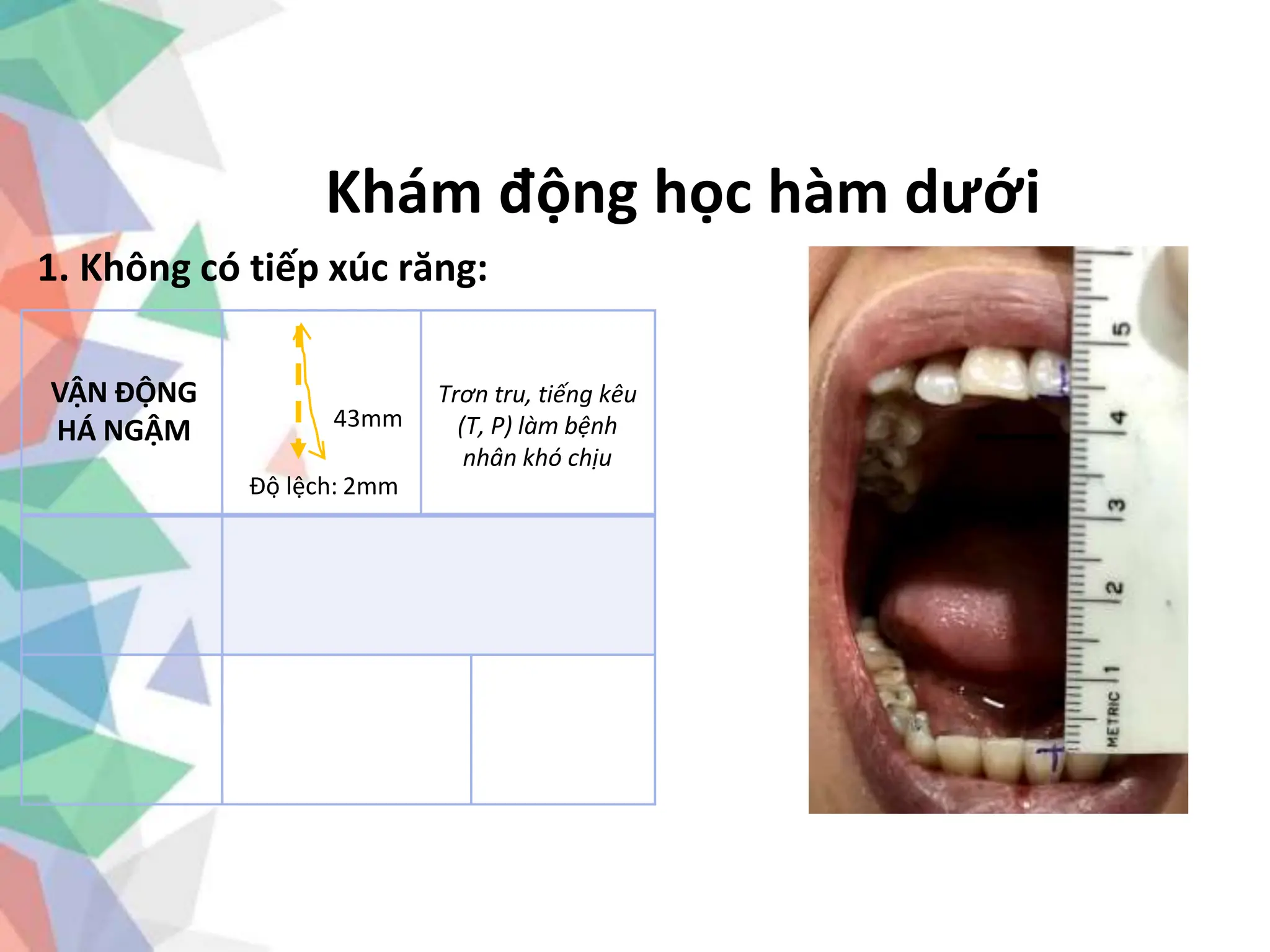 Bệnh án rối loạn TDH - Răng hàm mặt | PPTX