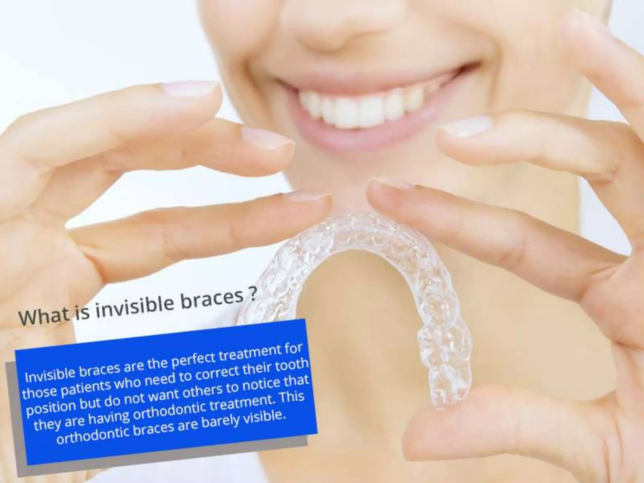 Benefits of invisible braces | PPT
