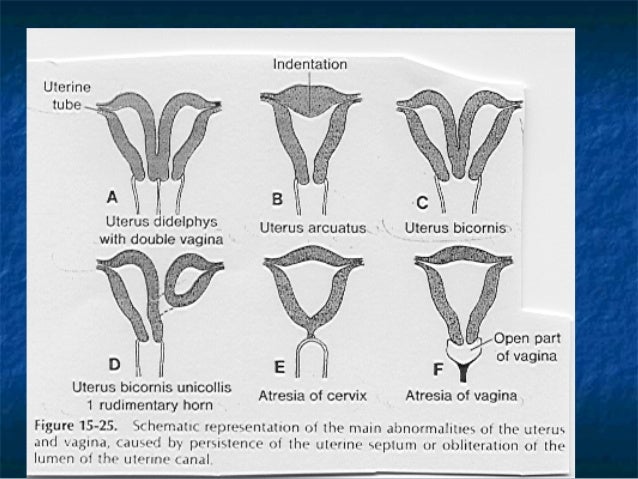 Benign disease of the uterus