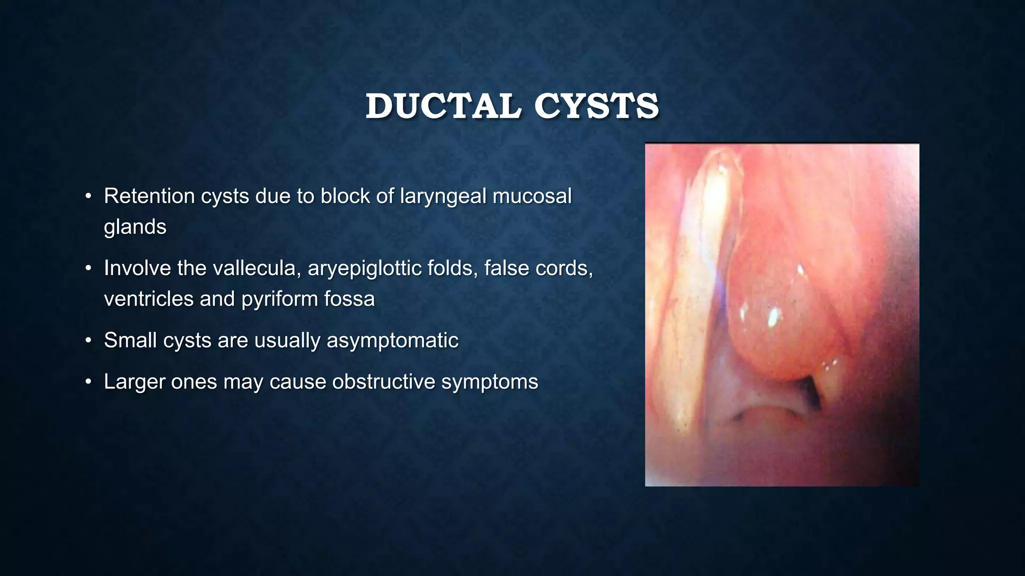 Benign lesions of larynx | PPTX