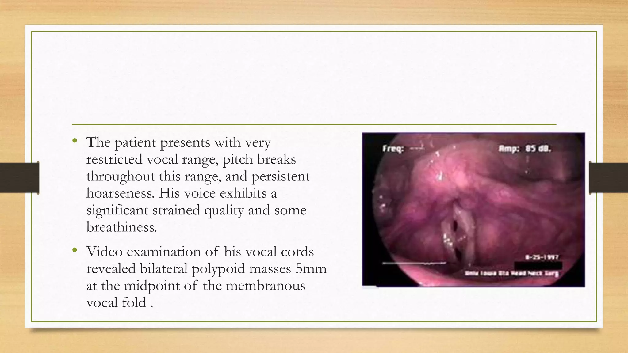 Benign lesions of larynx | PPTX