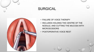 Benign lesions of larynx | PPTX