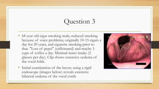 Benign lesions of larynx | PPTX