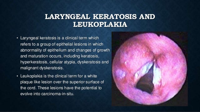 Benign lesions of larynx
