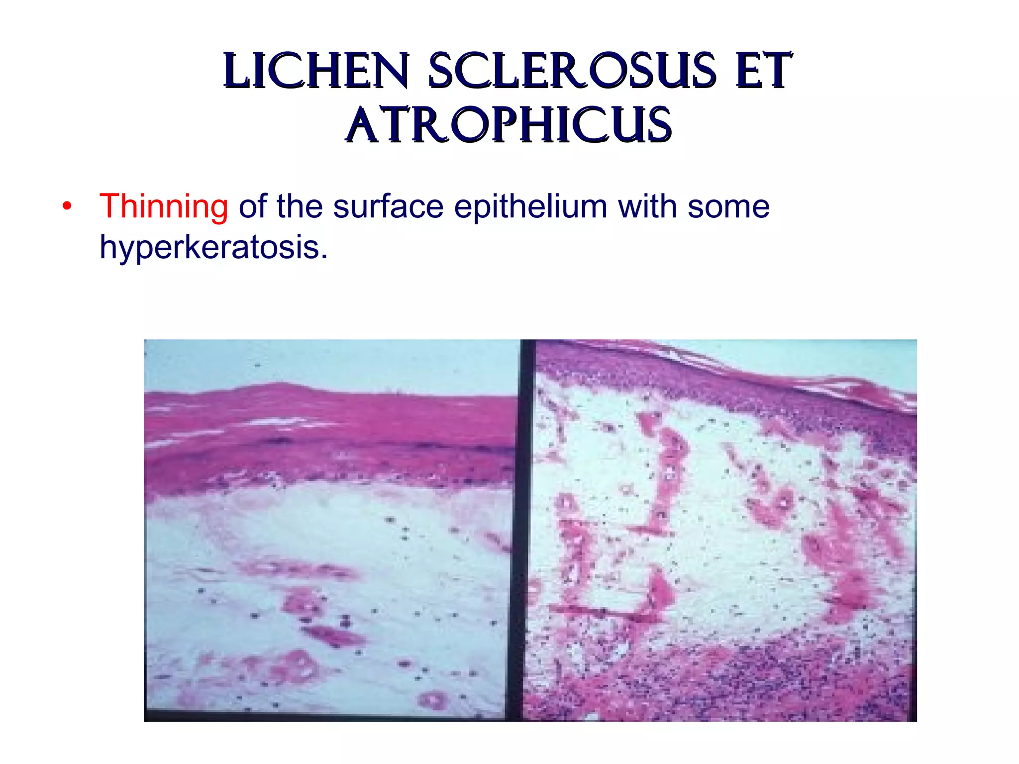 Benign diseases-of-the-vulvavagina-and - copy | PPT