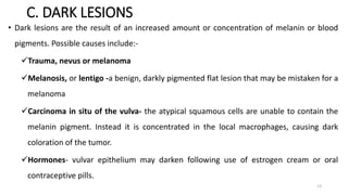 Benign and malignant disorders of the Vulva.pdf