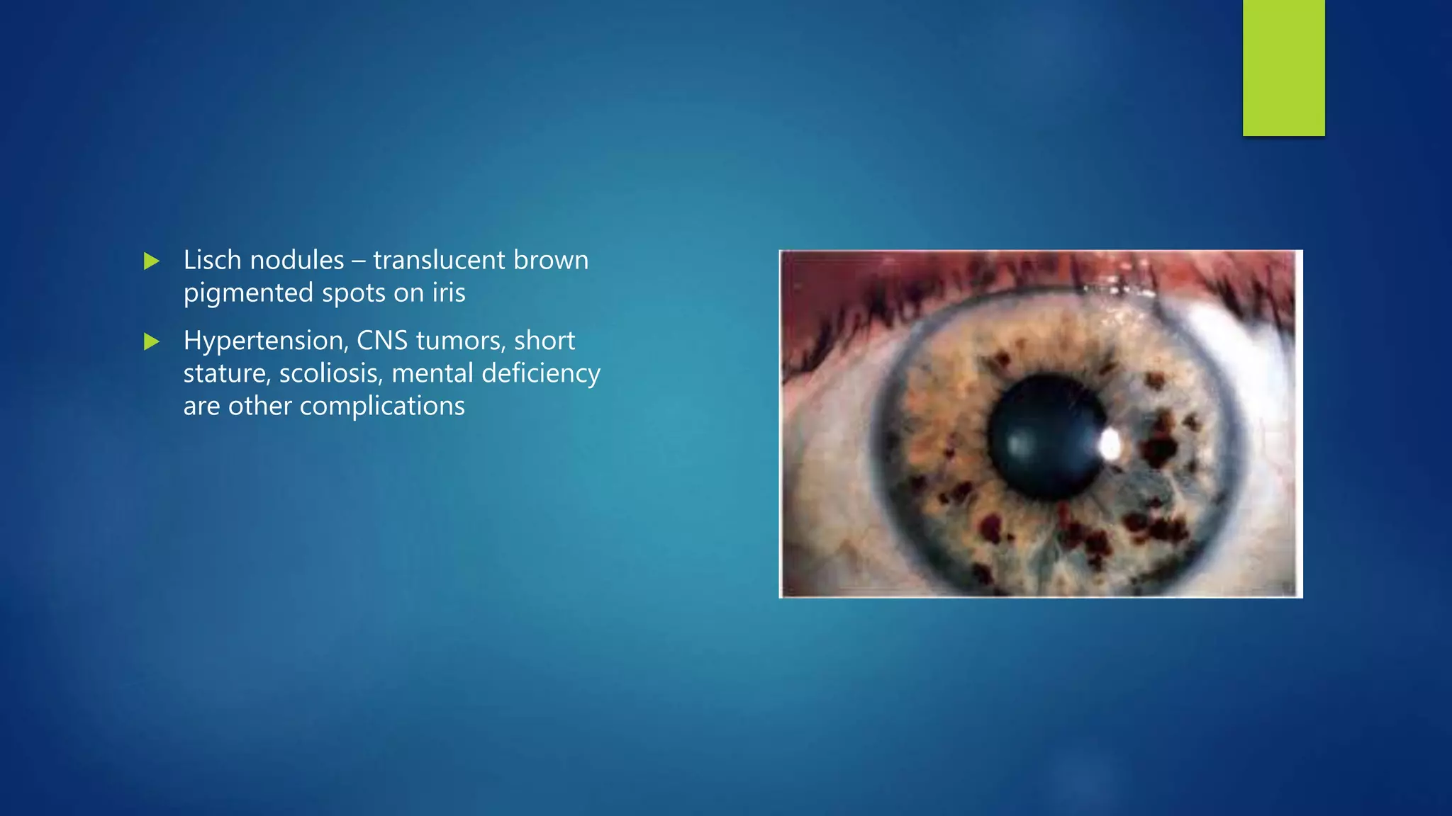 Benign and malignant nerve sheath tumors | PPTX