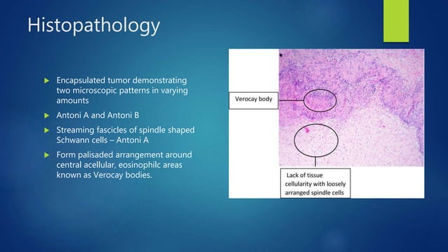 Benign and malignant nerve sheath tumors | PPTX