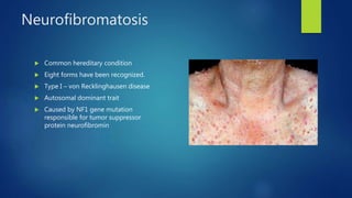 Benign and malignant nerve sheath tumors | PPTX