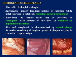 benign tumors of epithelial origin of oral cavity | PPTX