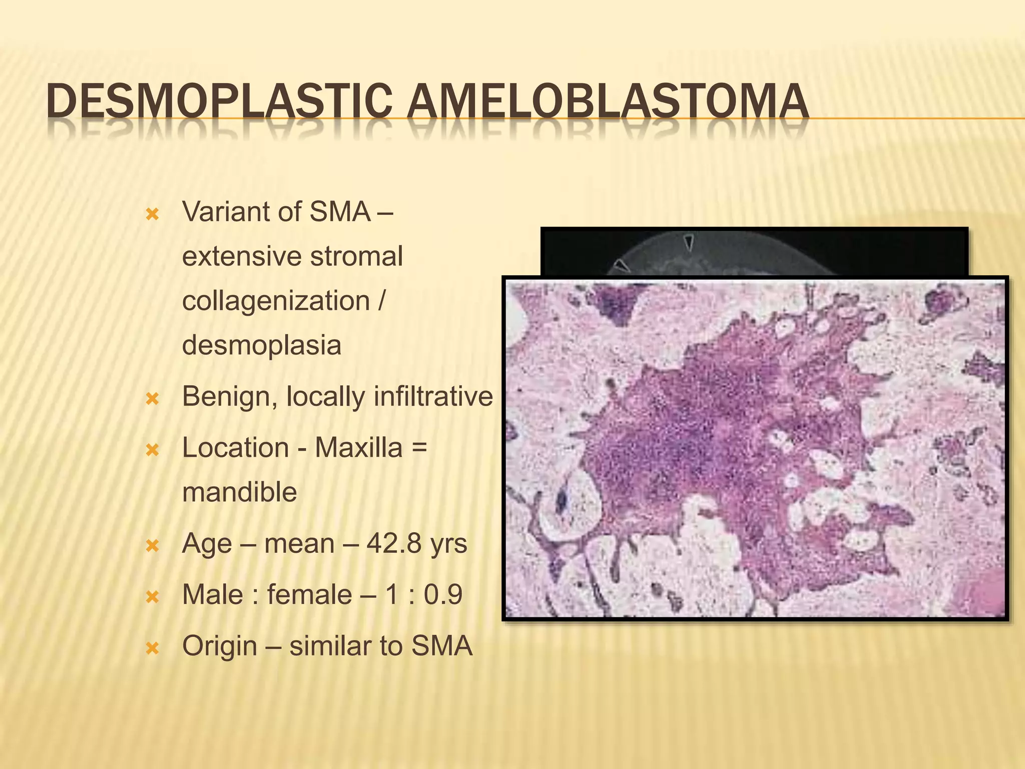 Benign and Malignant Tumours | PPTX