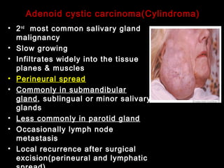 Cylindroma Treatment