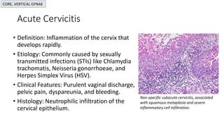 benign and premalignant lesions of cervix (2).pdf