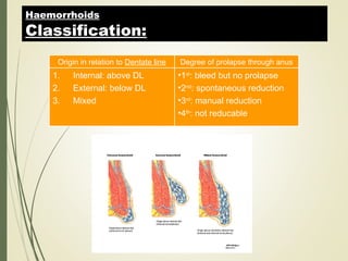 Benign Anorectal-Diseases Dr. Omongo.ppt