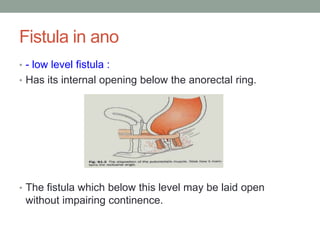 Benign anorectal disease | PPTX