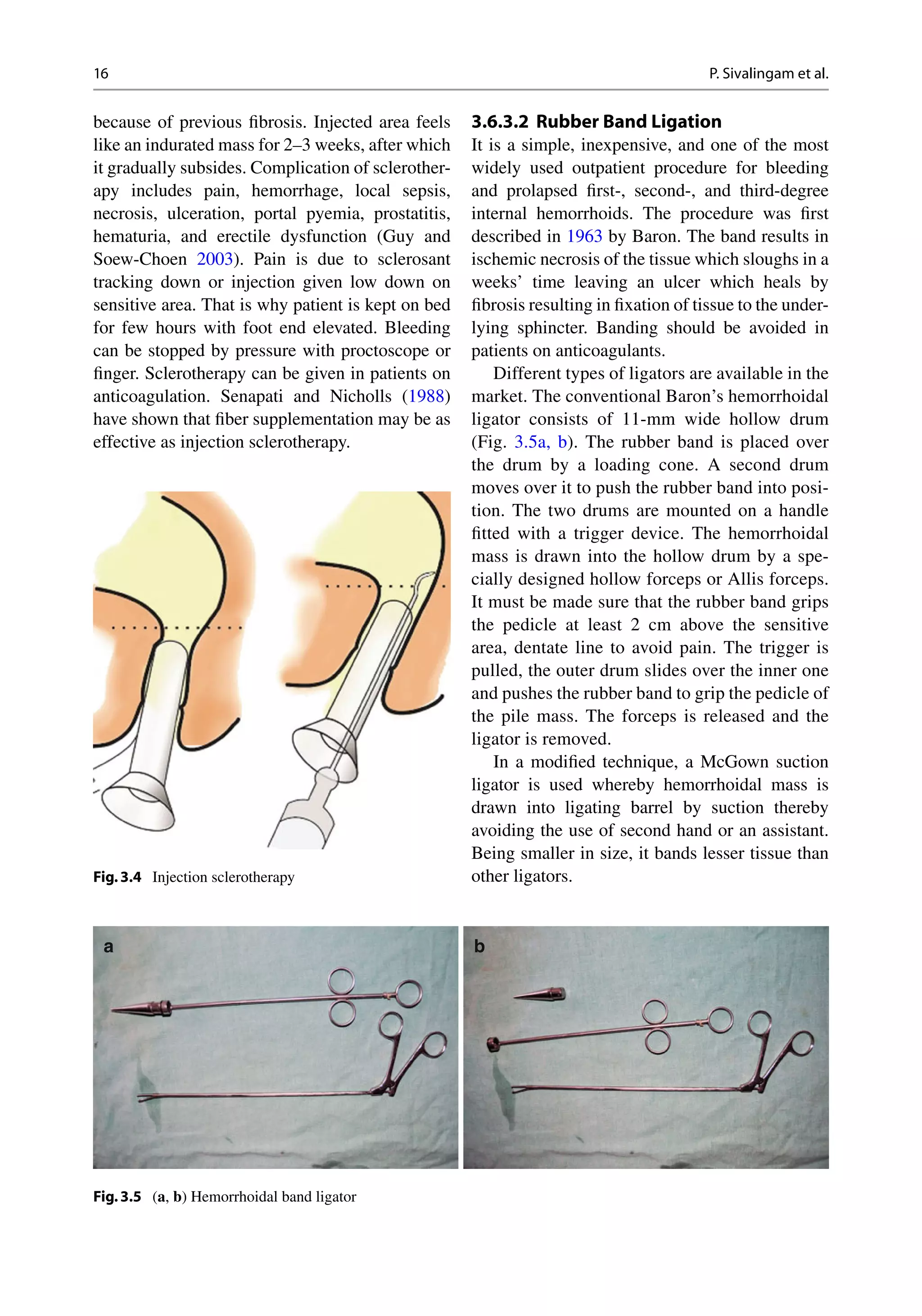 Benign anorectal disorders | PDF