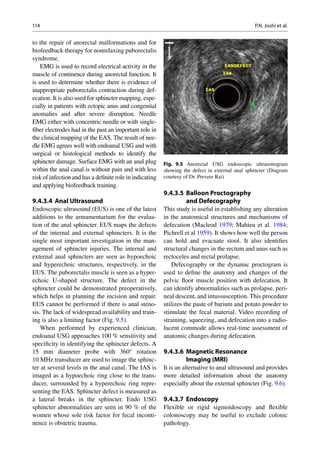 Benign anorectal disorders | PDF