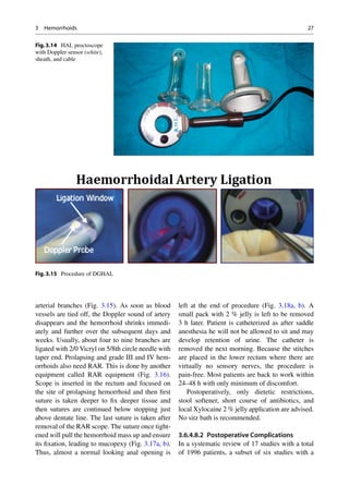 Benign anorectal disorders | PDF