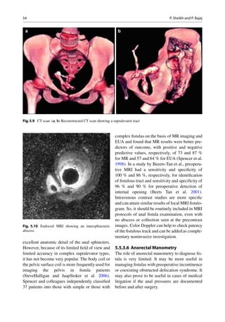 Benign anorectal disorders | PDF