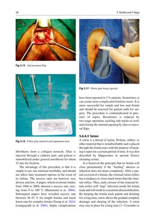 Benign anorectal disorders | PDF