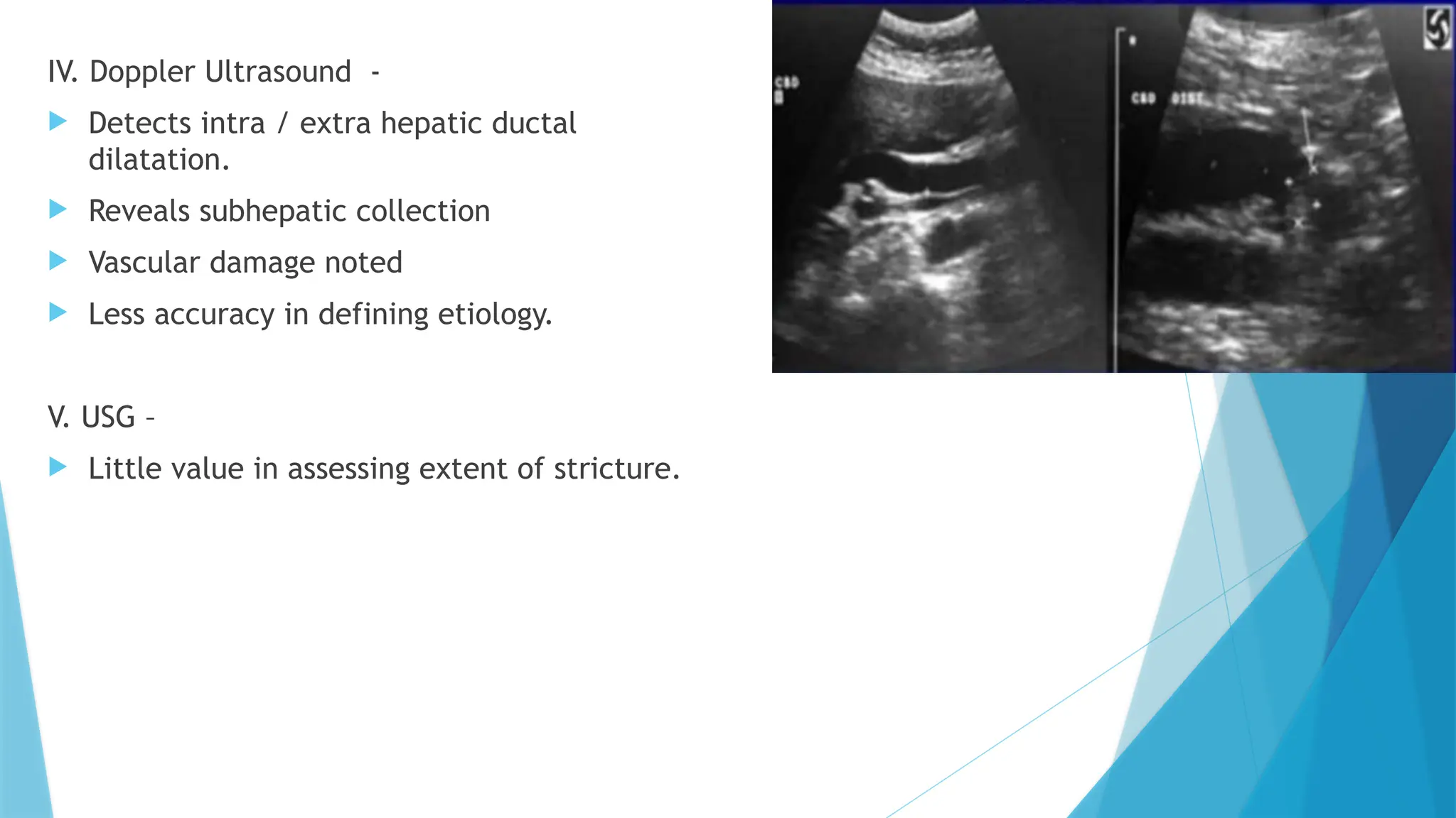 Benign biliary stricture of common bile duct 2.pptx