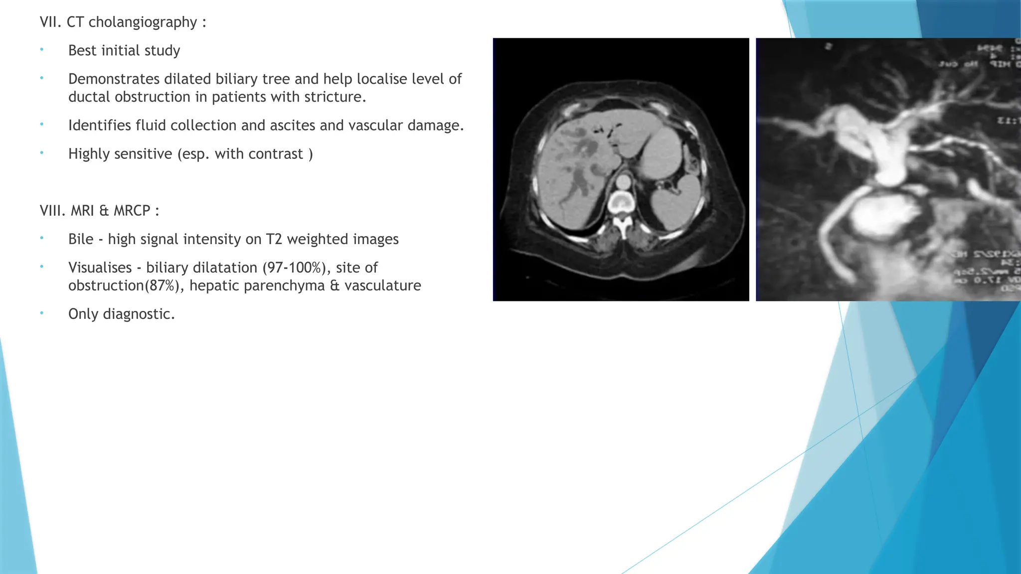 Benign biliary stricture of common bile duct 2.pptx