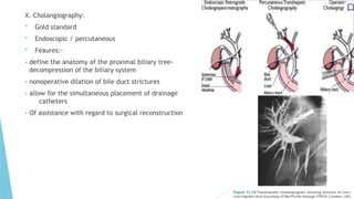 Benign biliary stricture of common bile duct 2.pptx