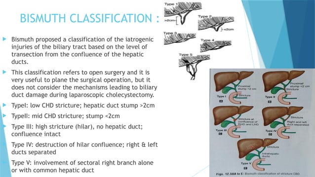 Benign biliary stricture of common bile duct 2.pptx
