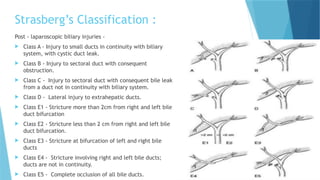 Benign biliary stricture of common bile duct 2.pptx