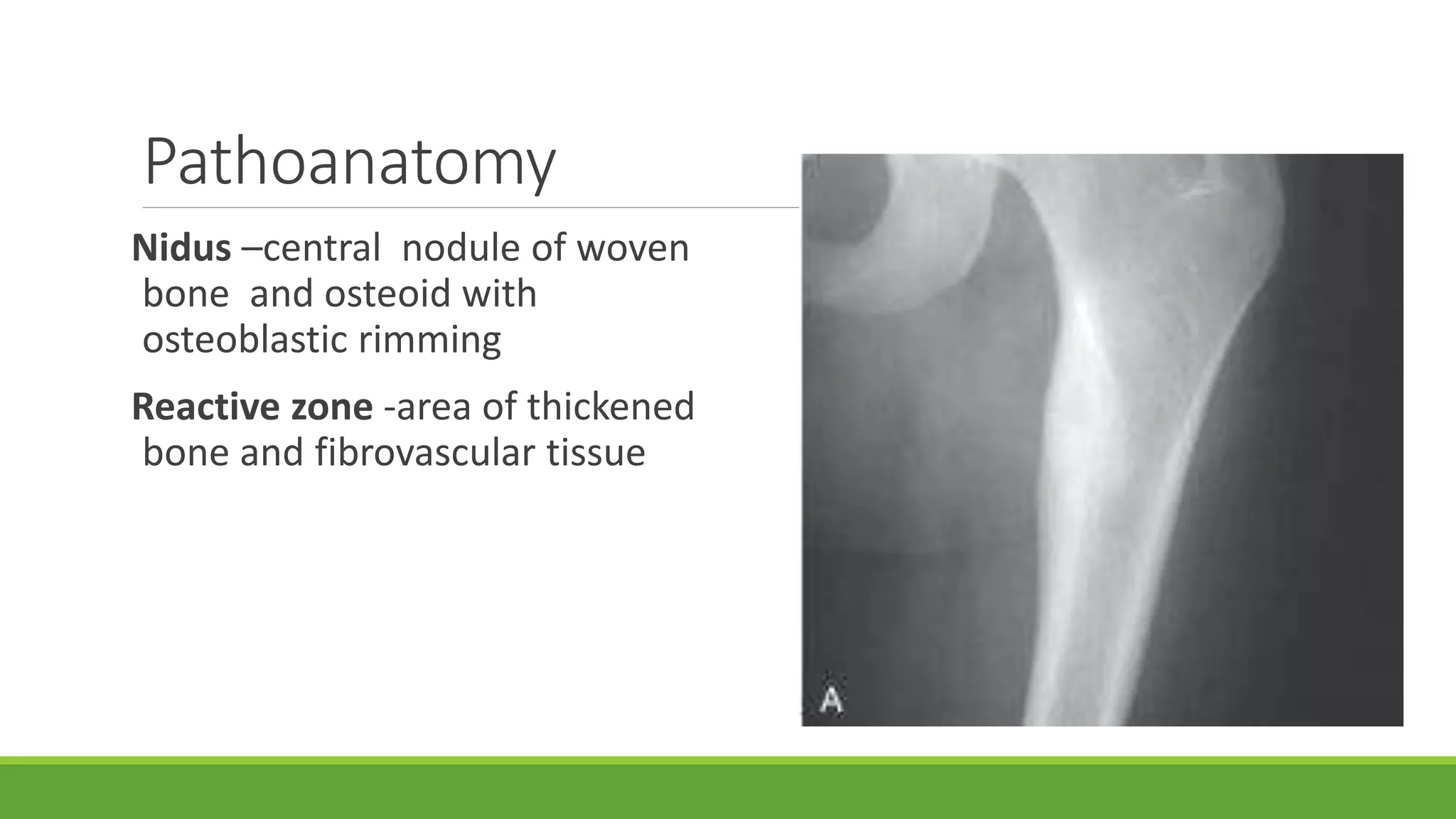 Benign bone forming tumors | PPTX