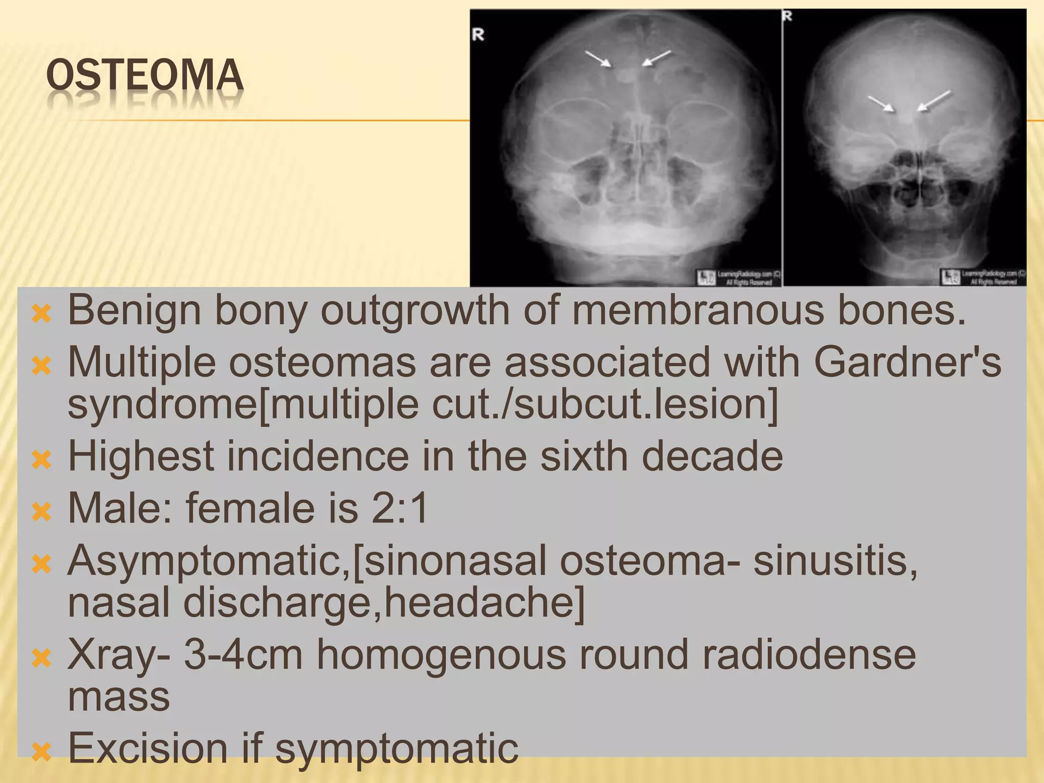 Benign bone tumor ppt | PPTX