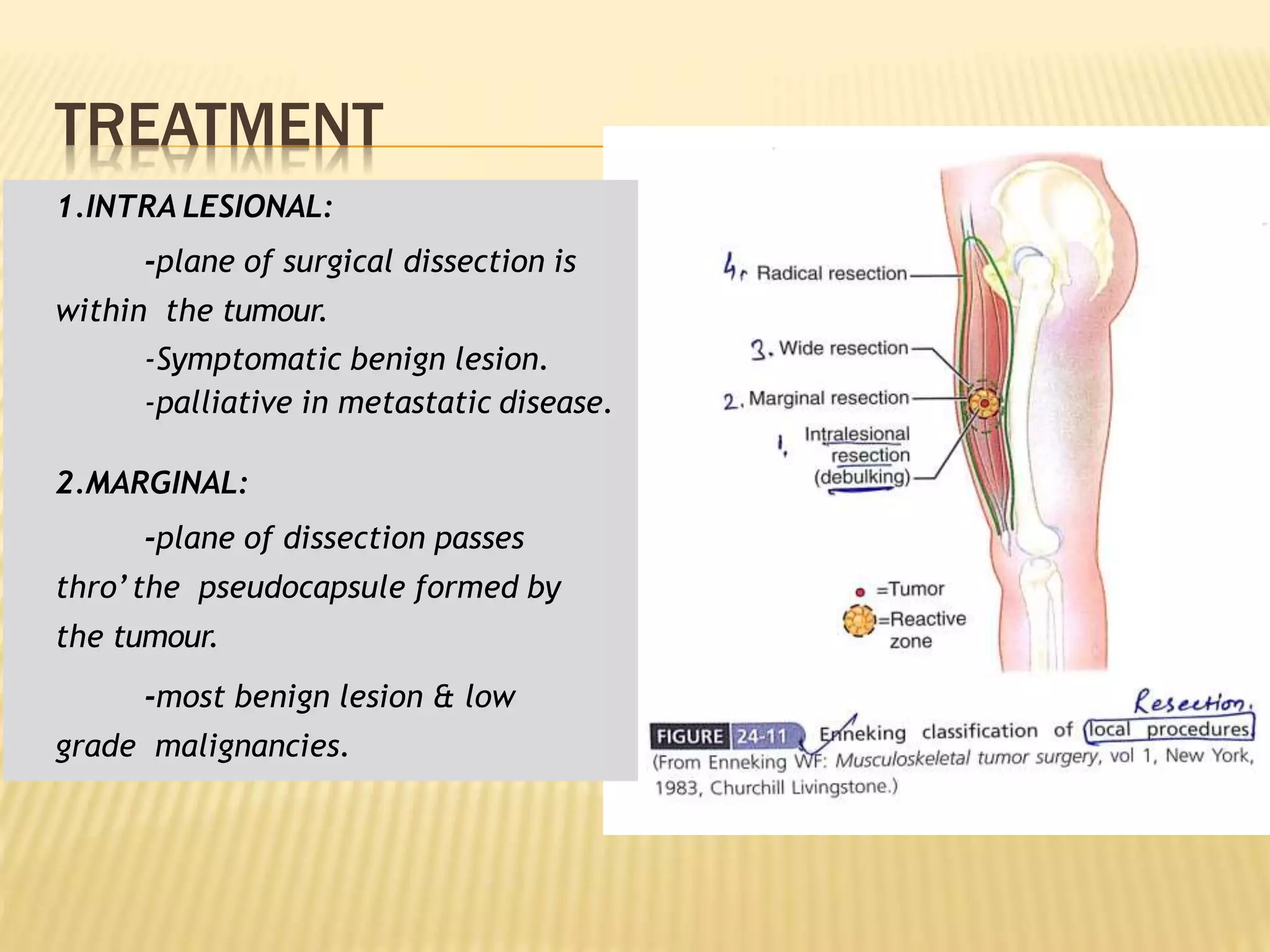 Benign bone tumor ppt | PPTX