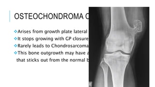 Benign bone tumors | PPTX