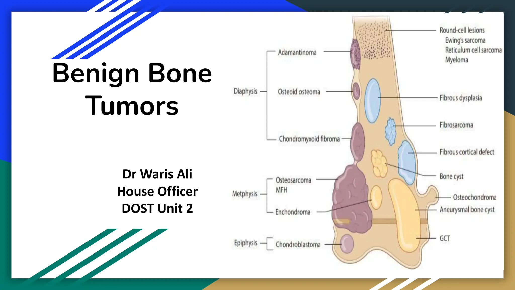 Benign Bone Tumors basics explained well | PDF
