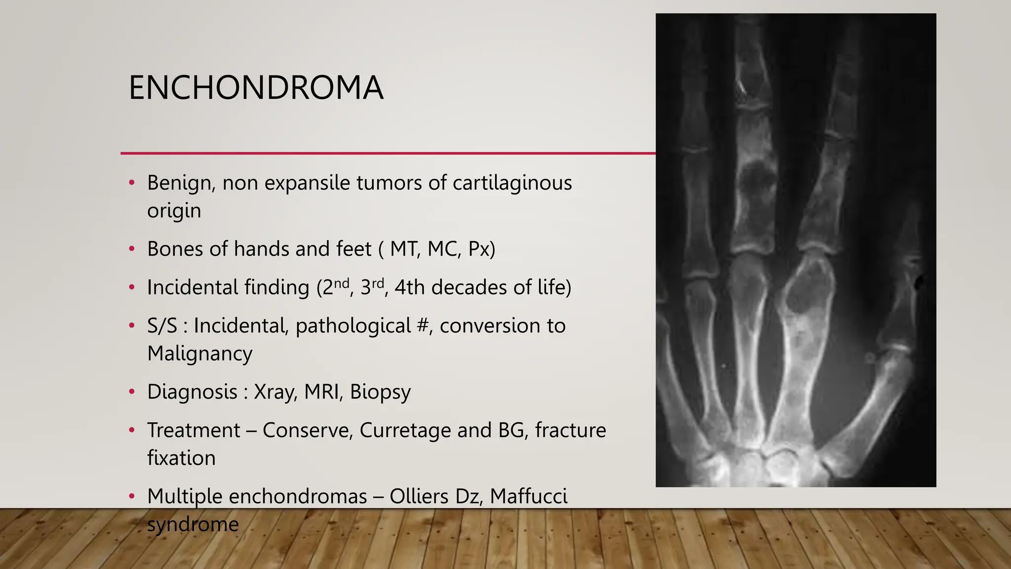 Benign bone tumors (Nutshell) | PPT