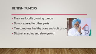 Benign bone tumors (Nutshell) | PPTX