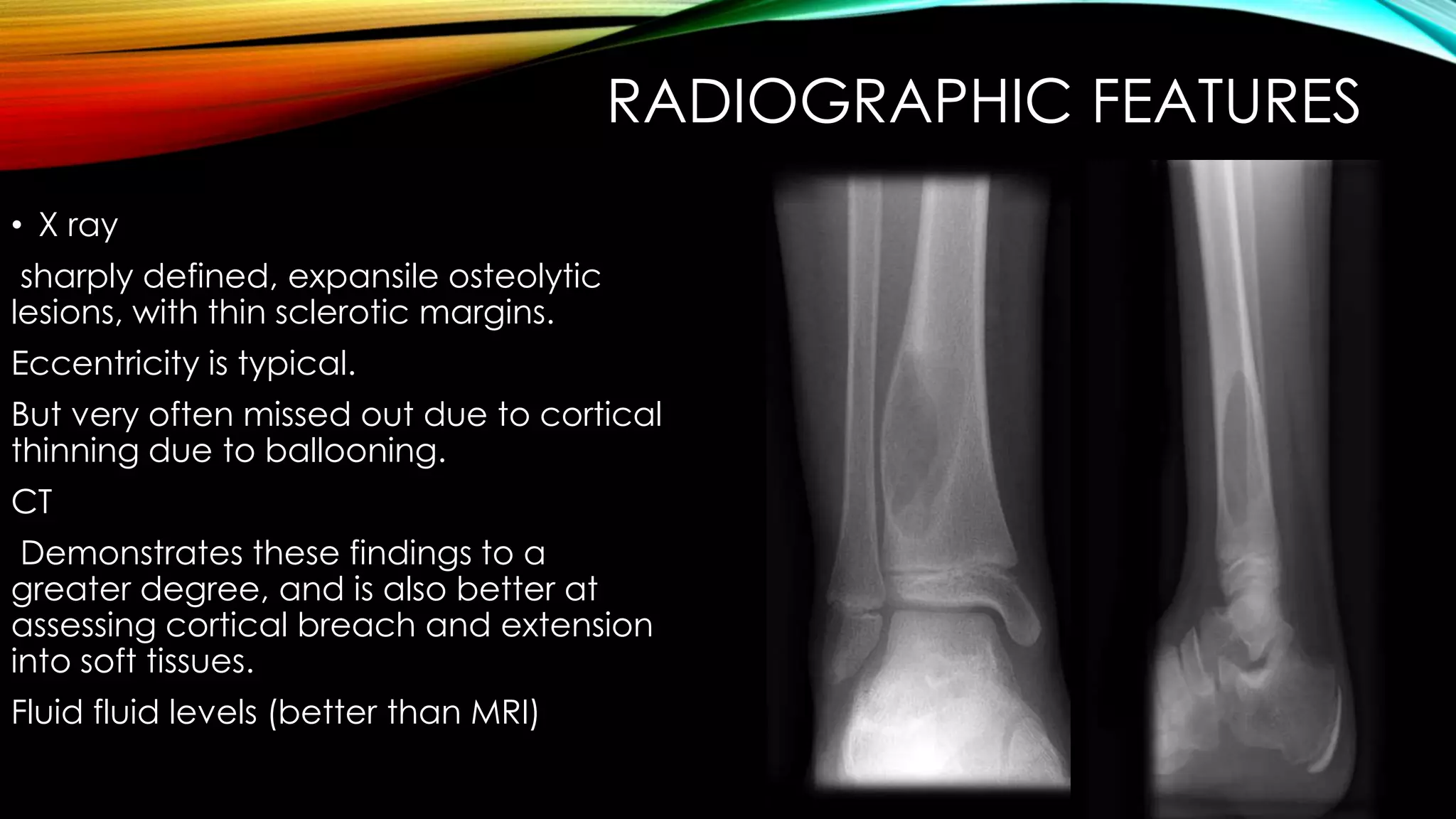 Benign bone tumours | PPTX