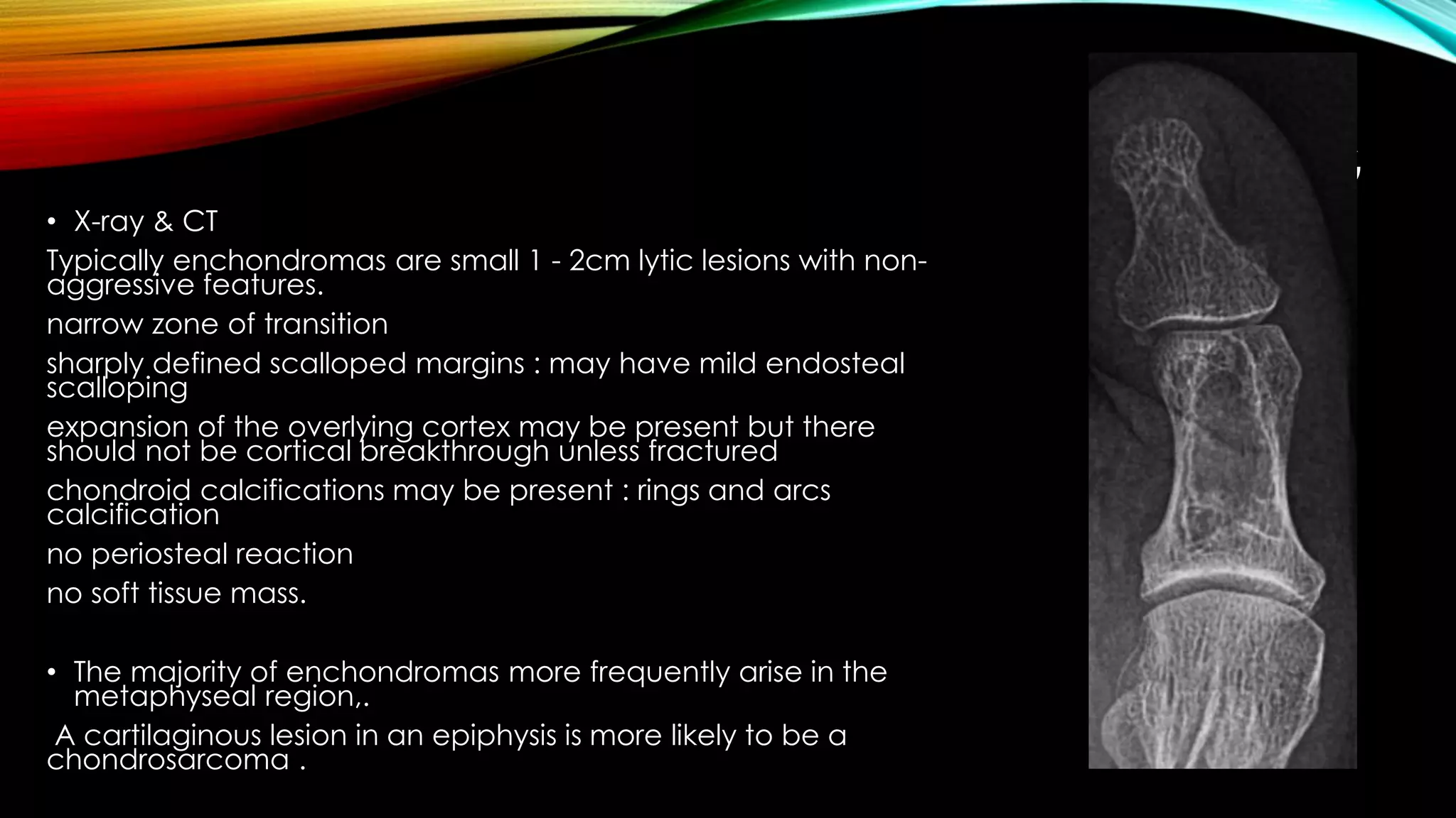 Benign bone tumours | PPTX