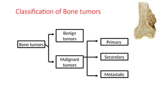 BENIGN BONE TUMOURS.pptx Radiology Benign | PPTX