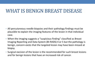 Benign breast disease | PPTX