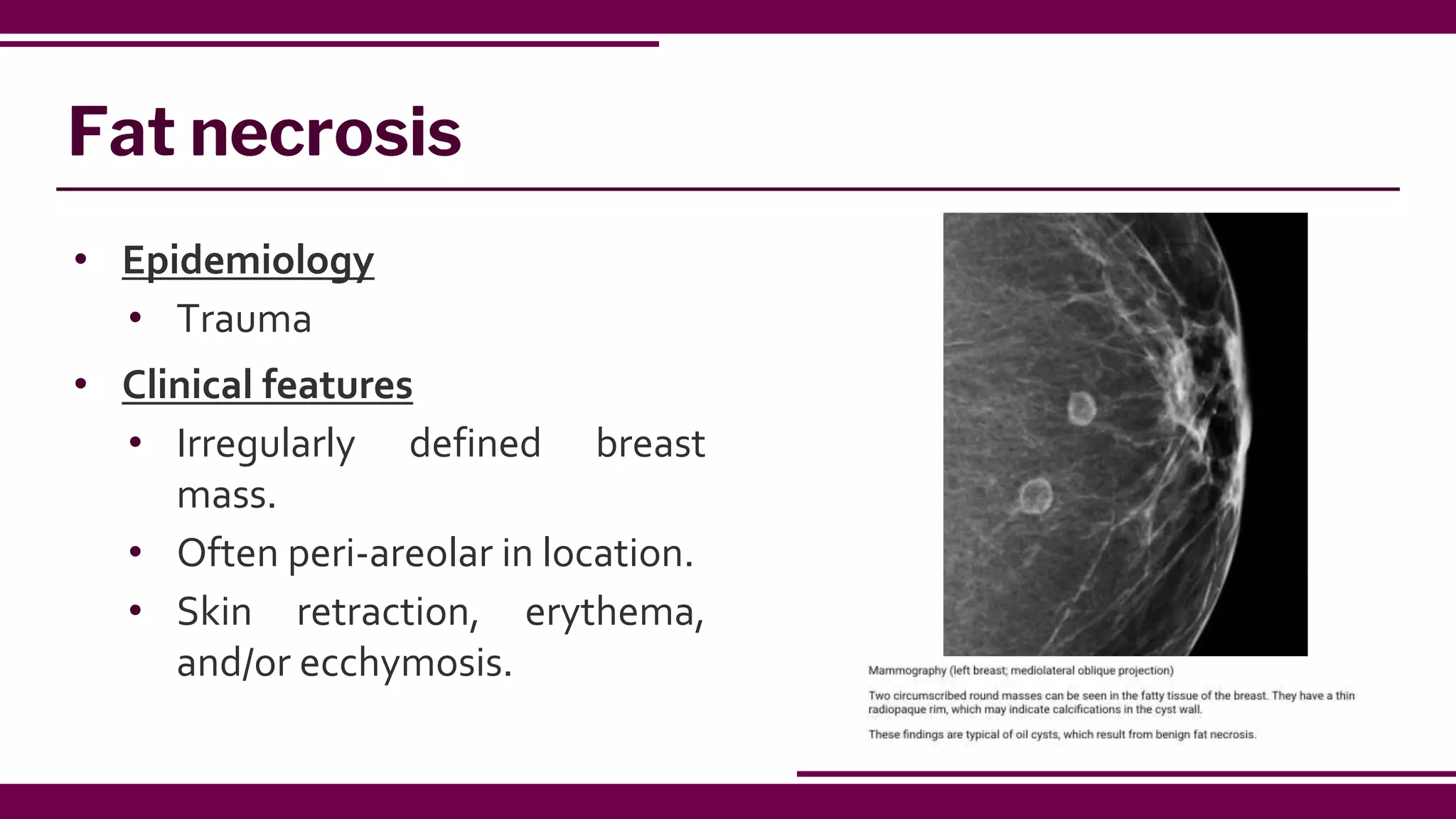 Benign breast conditions.pptx