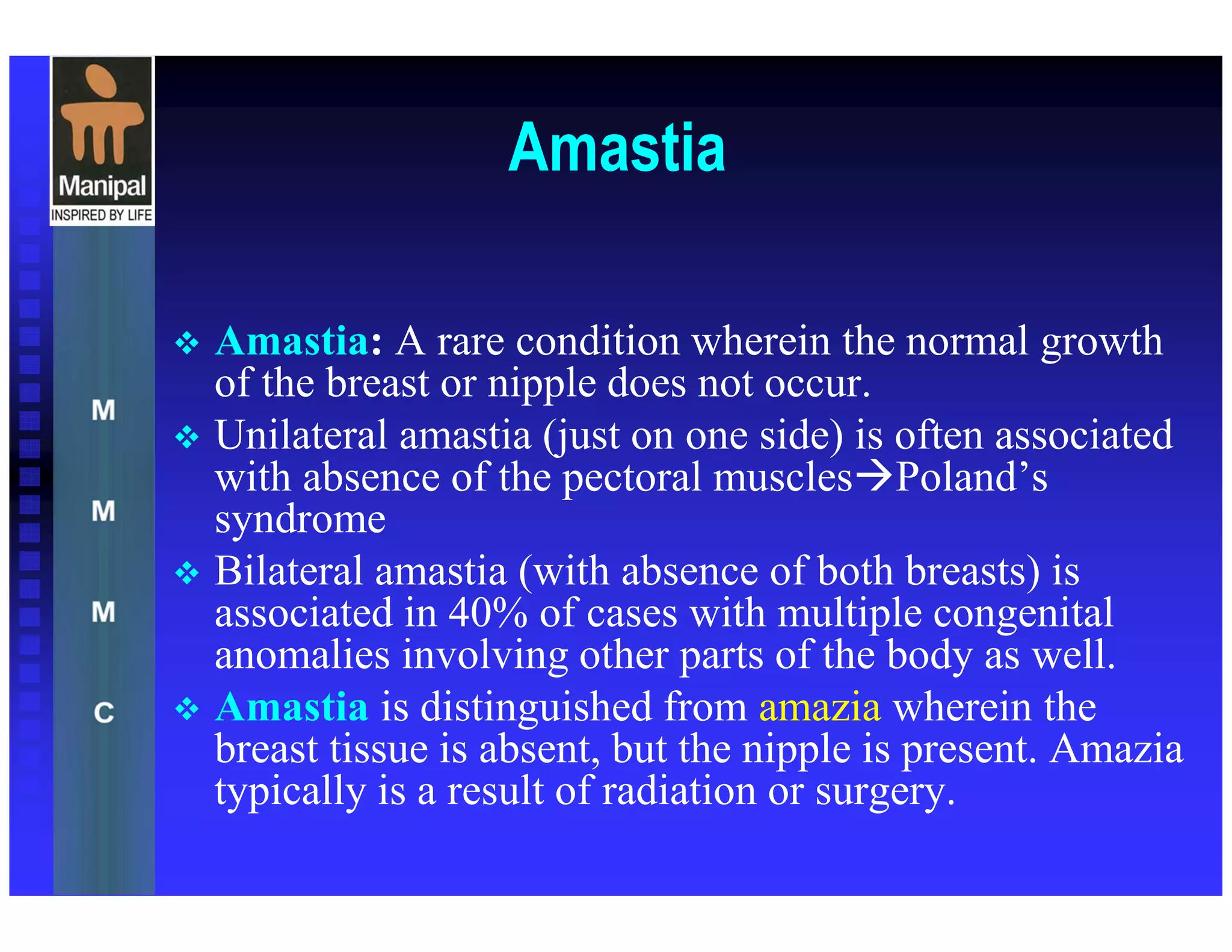 Benignbreastdisease 121116083120-phpapp01 1 | PDF