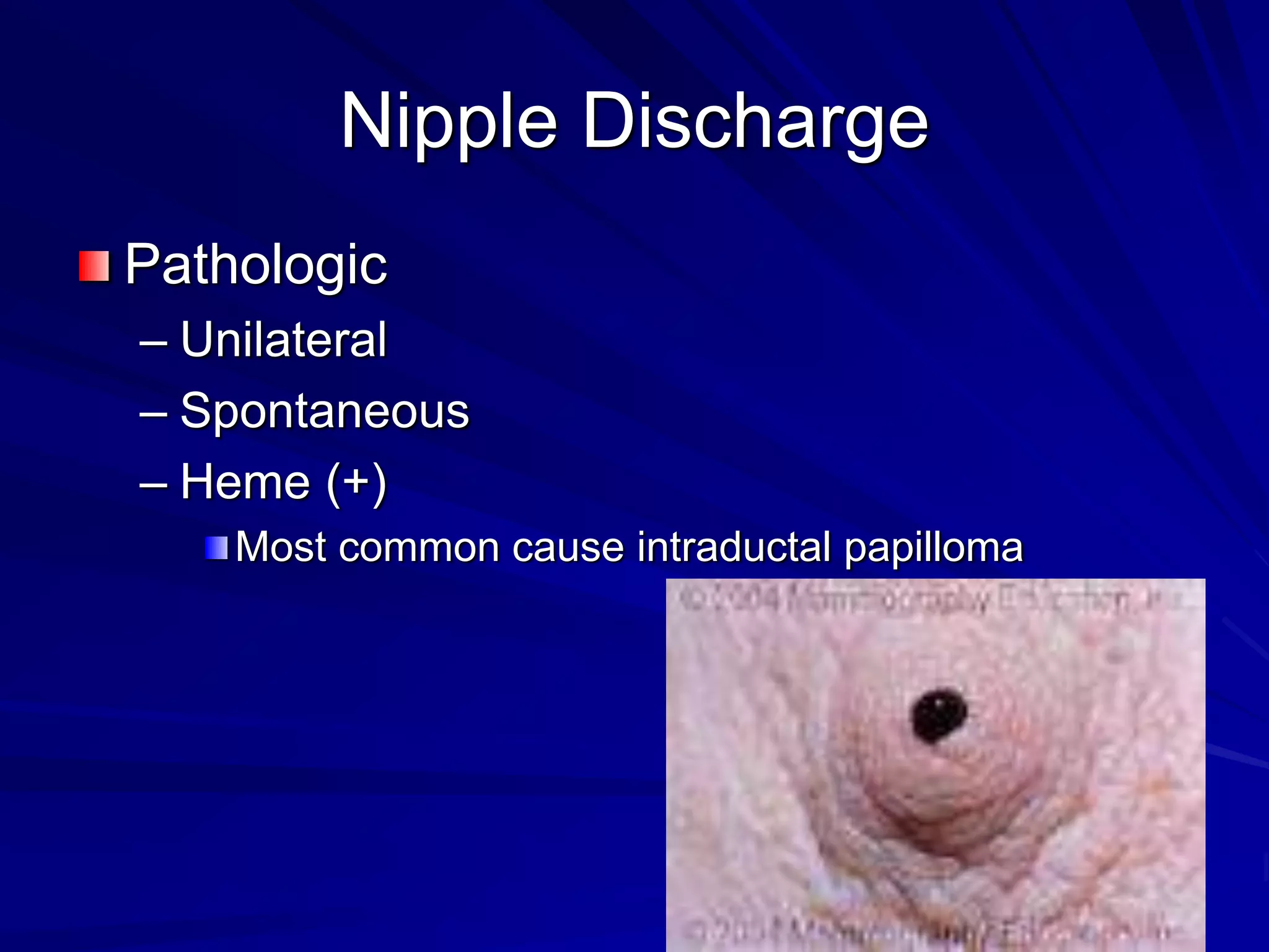 Benign breast disease | PPT