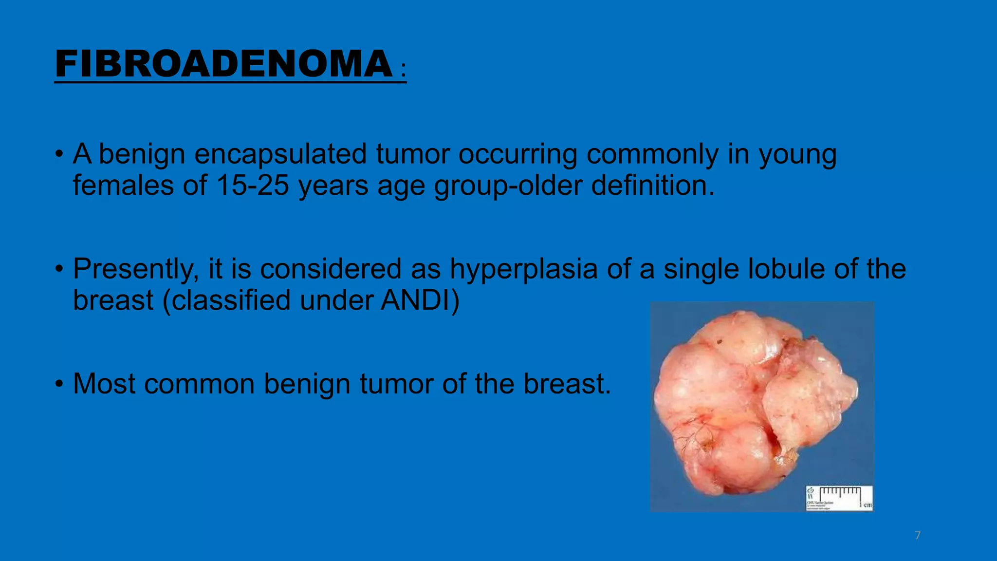 BENIGN BREAST DISEASE copy.pptx