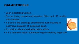 BENIGN BREAST DISEASE copy.pptx