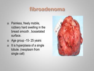 Benign breast disease dr mnr | PPTX