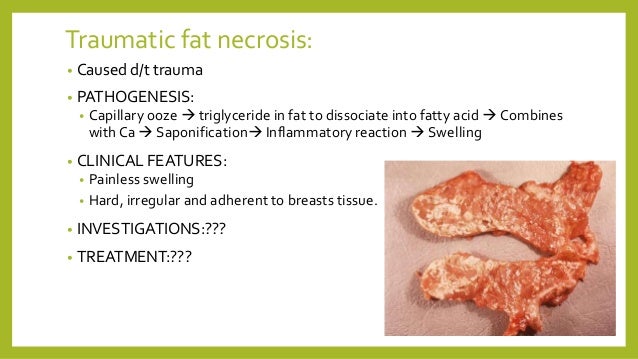 Benign breast diseases