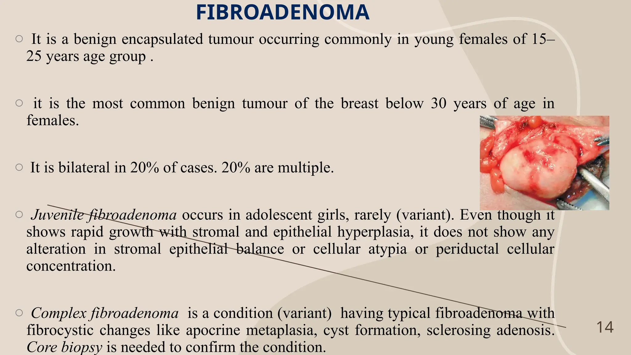 approach to BENIGN BREAST DISEASES.pptx