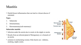 Benign Breast Disorders.pptx.knowledge attitude | PPT